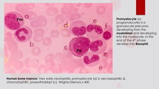 Proerythroblast Vs Promyelocyte