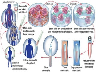STEM CELL / BONE MARROW TYPES PROCESS TRANSPLANTATION AND TREATMENT | PPTX