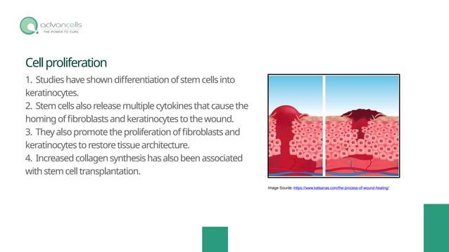 Stem Cell-Based Therapeutics: A New Horizon in Wound Healing | PPT