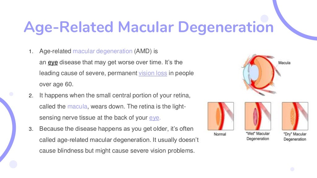 Stem Cell Age Related Macular Degeneration Treatment.pptx