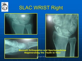 Stem Cell Case Study By Dr. Bennett | PPT