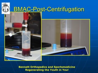 Stem Cell Case Study By Dr. Bennett | PPT