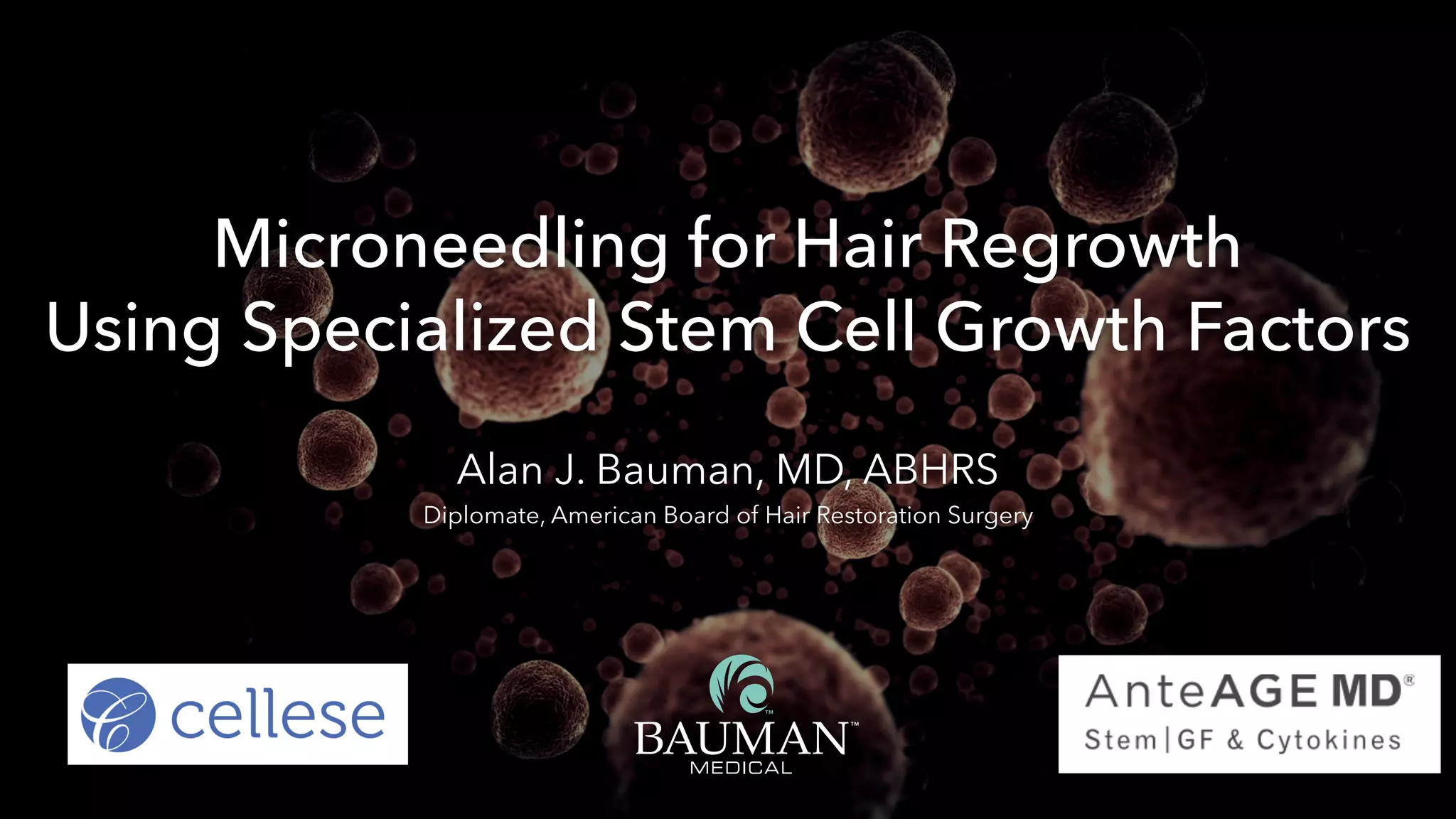 Stem Cell Growth Factor Exosomes for Hair Regrowth - DrAlanBauman_final ...