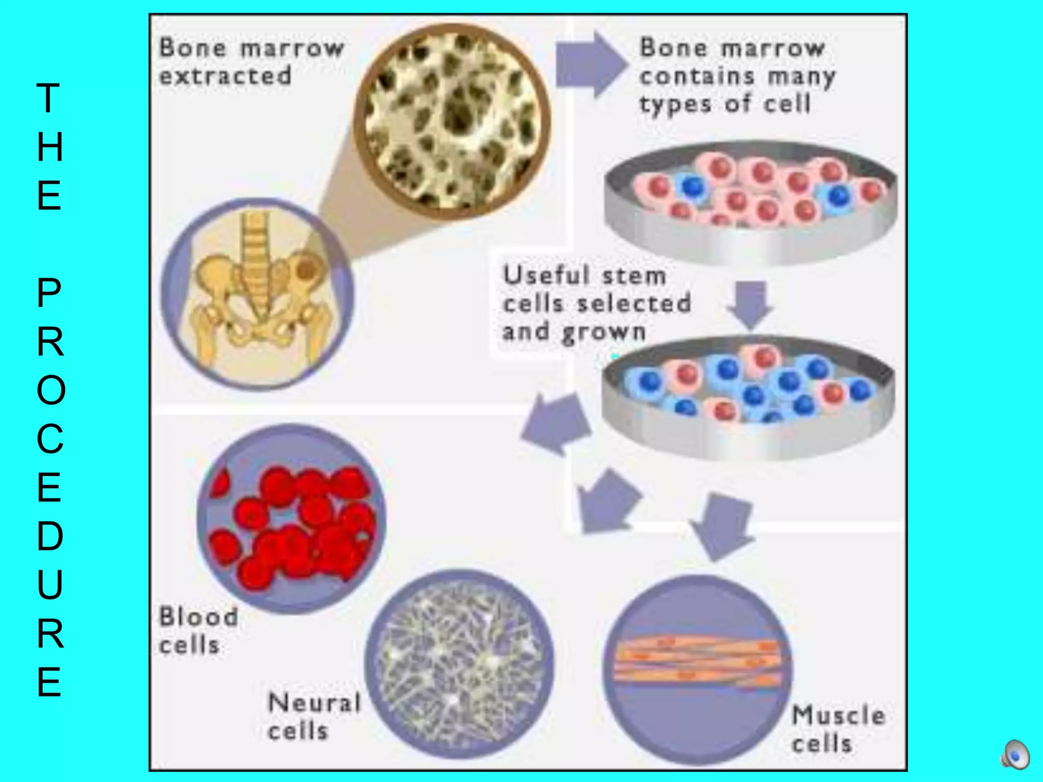 Stem cell project | PPTX
