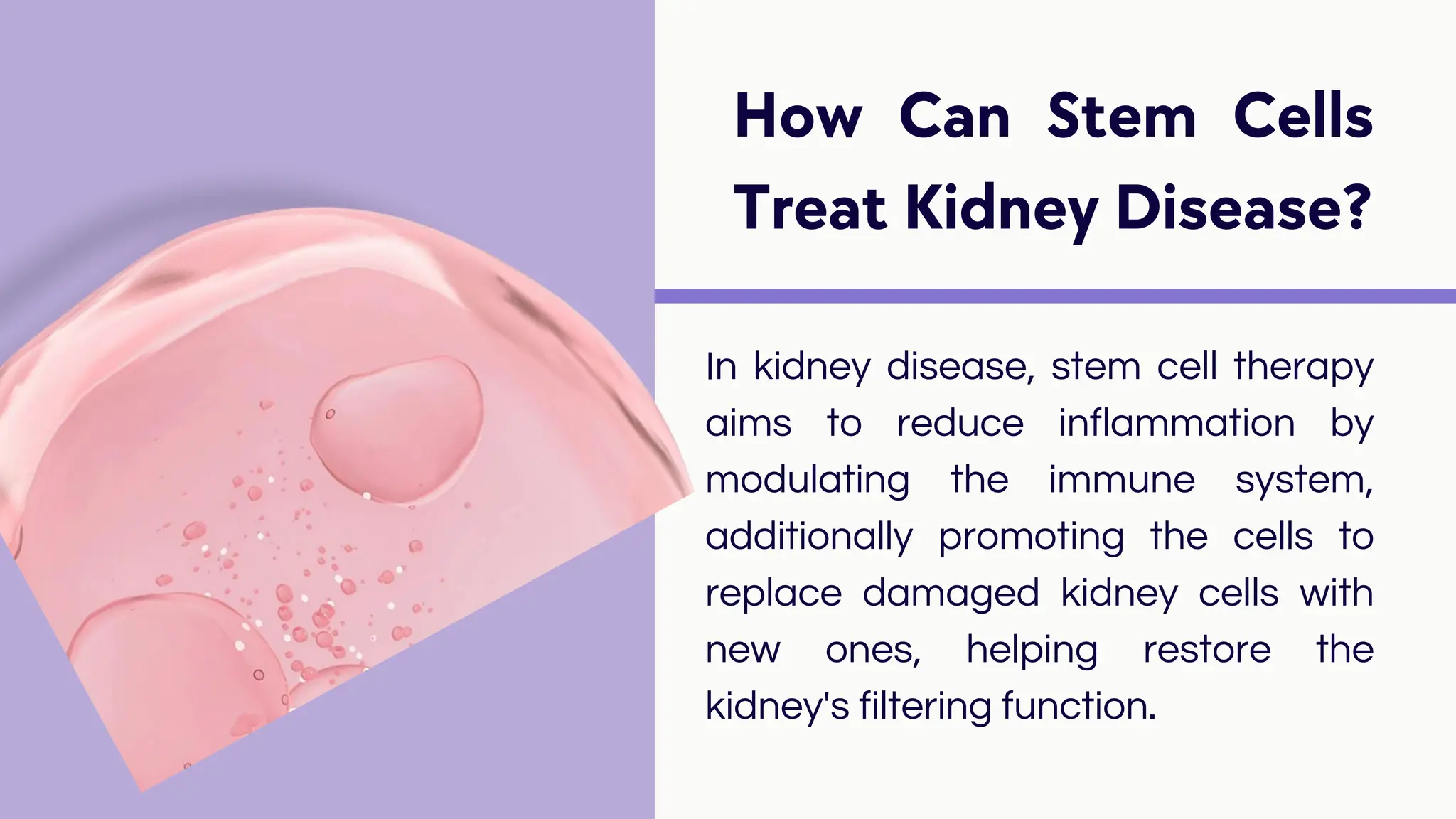 Stem Cells and Kidneys: Pioneering Treatments for Renal Diseases | R3 ...