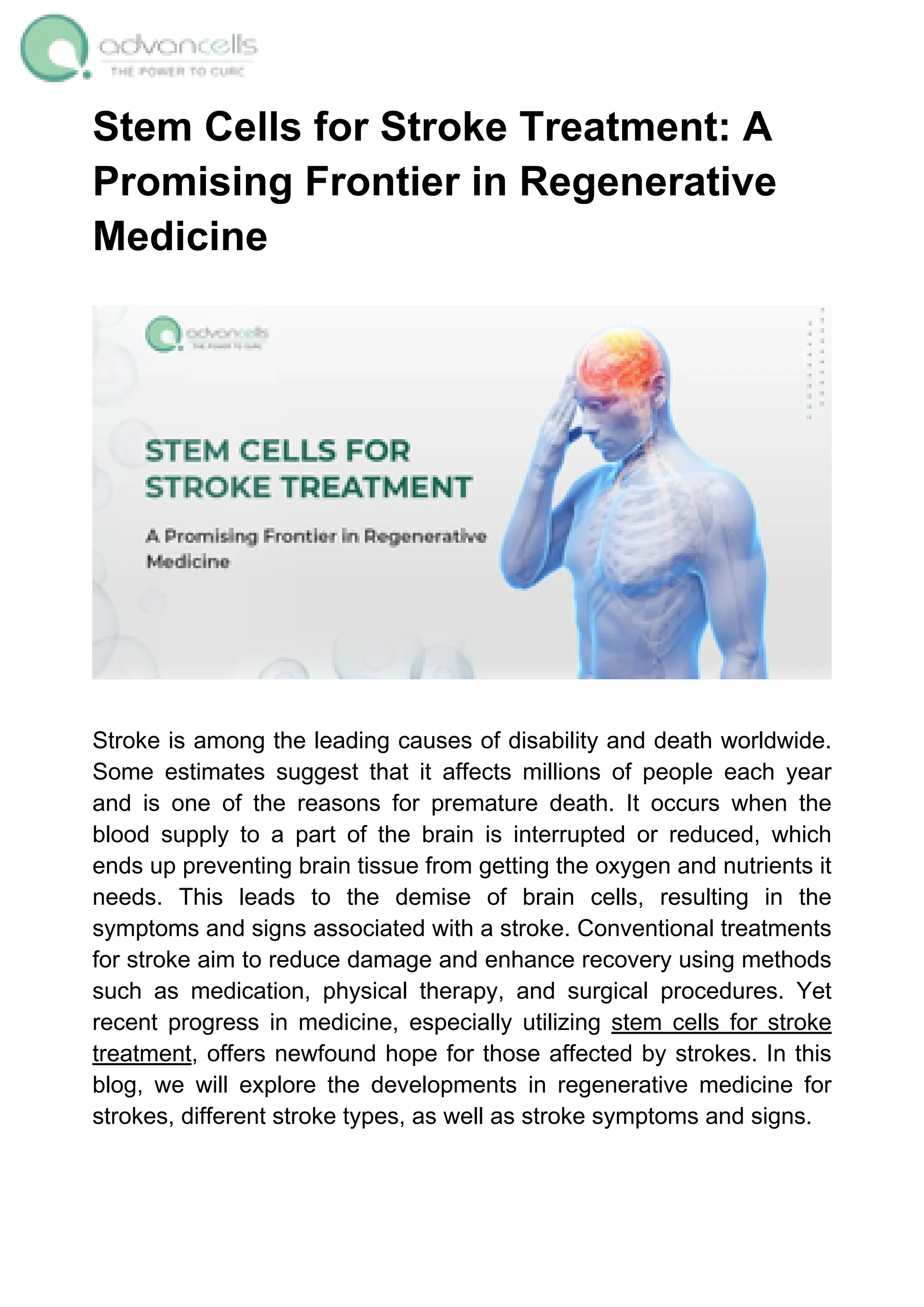 Stem Cells for Stroke Treatment: A Promising Frontier in Regenerative ...