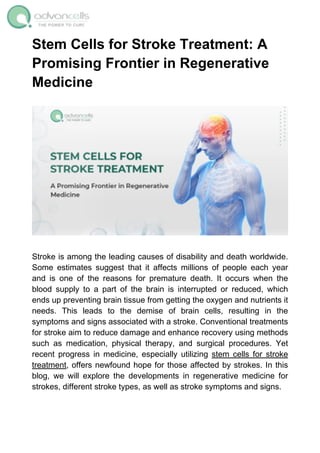 Stem Cells for Stroke Treatment: A Promising Frontier in Regenerative Medicine | PDF