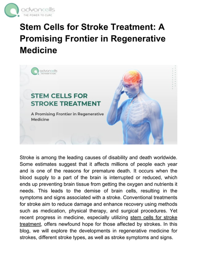 Stem Cells for Stroke Treatment: A Promising Frontier in Regenerative Medicine | PDF