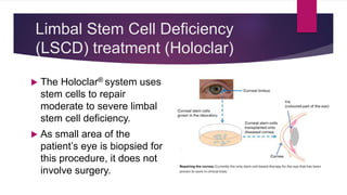 Stem Cells in Blindness Treatment | PPTX