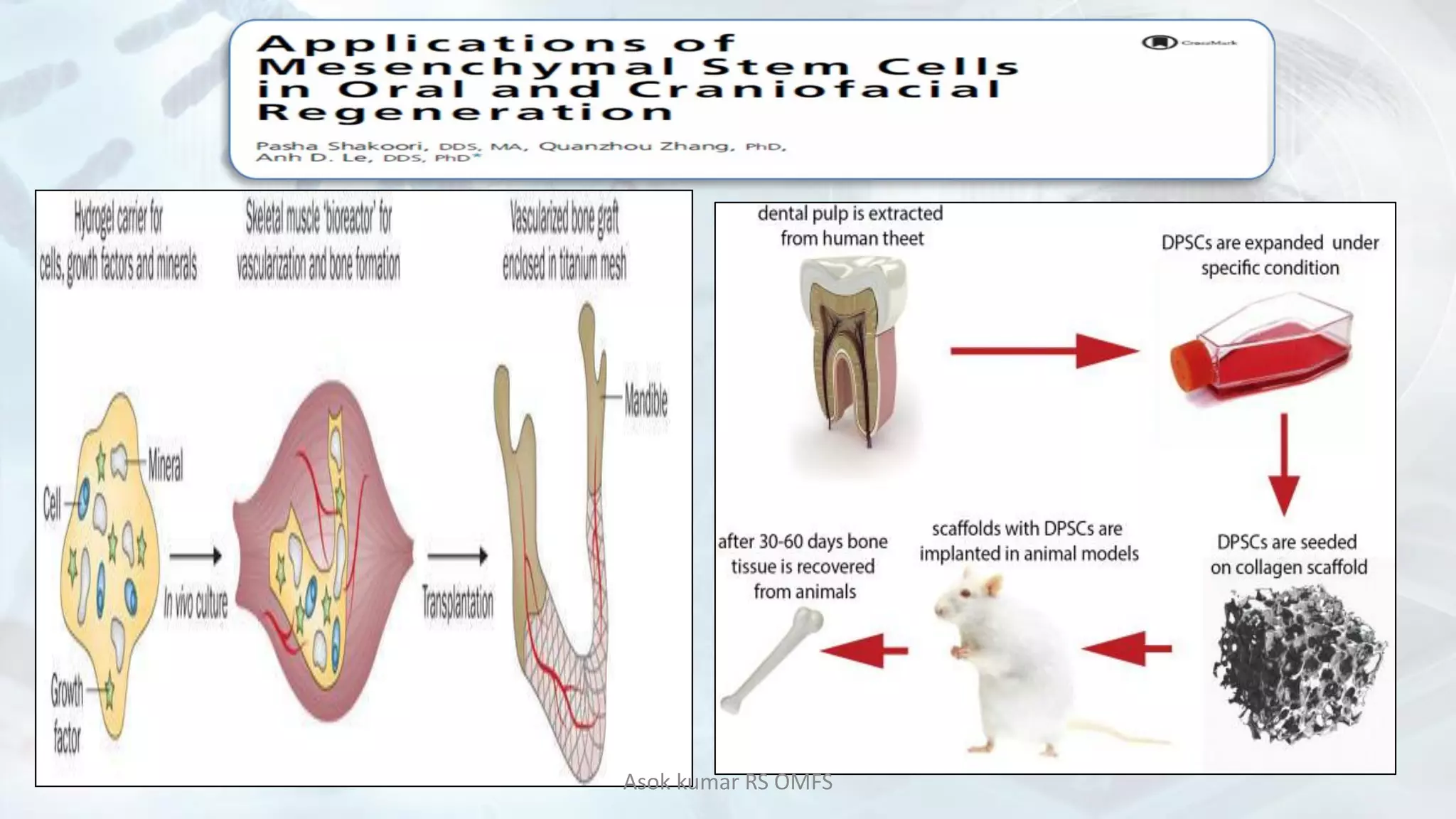 Stem cells in omfs | PDF