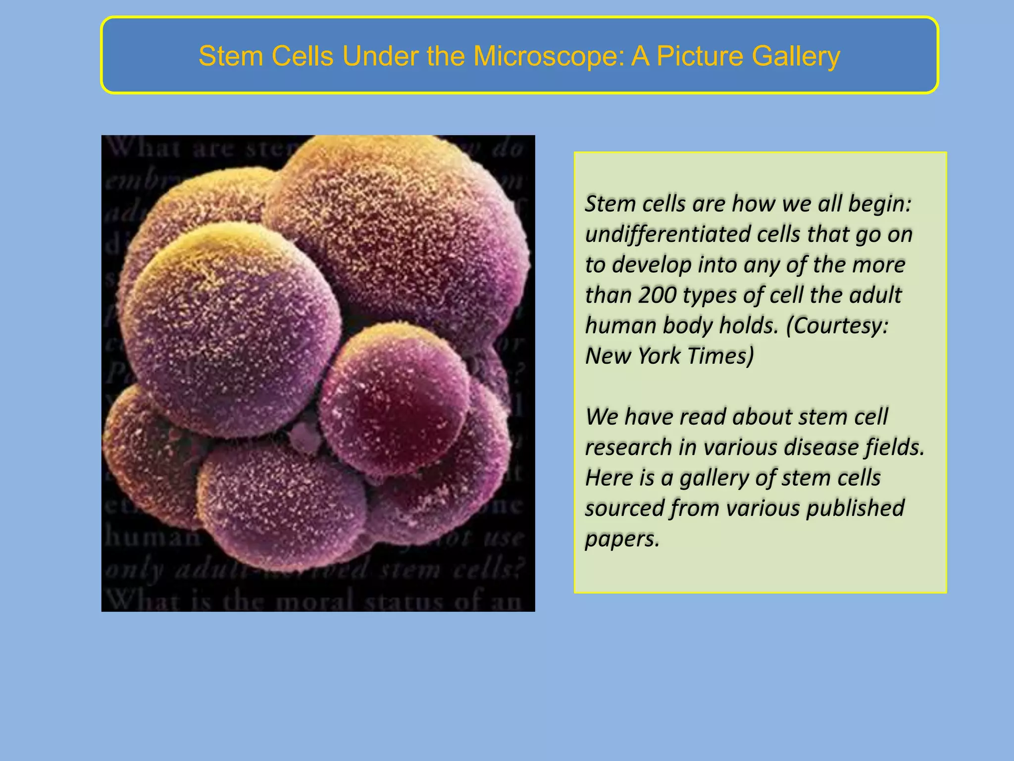 Stem cells under the microscope a picture gallery | PPTX