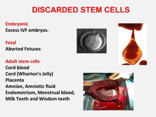 Stem cell therapy | PPT | Endocrine and Metabolic Diseases | Diseases ...