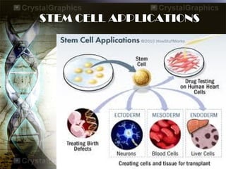 Stem cell therapy | POT