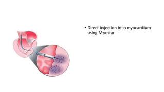 Stem cell therapy after myocardial infarction | PPTX