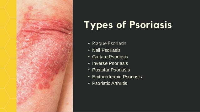 Stem Cell Therapy Effective In Treating Psoriasis - Dr. David Greene R3 ...