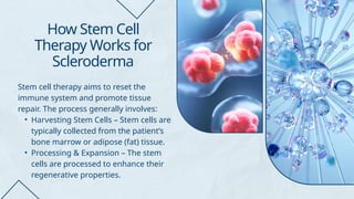 Stem Cell Therapy for Scleroderma Insights from Dr. David Greene R3 ...