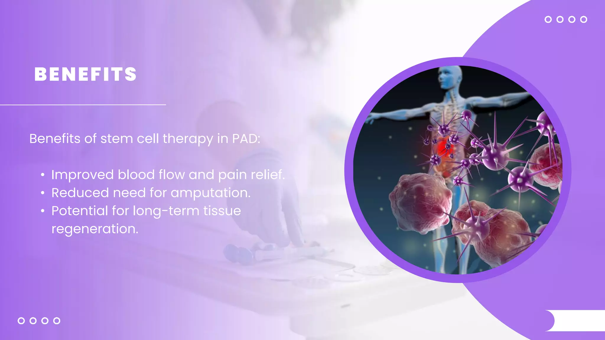 Stem Cell Therapy's Role in Managing Peripheral Artery Disease | Dr ...