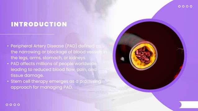 Stem Cell Therapy's Role in Managing Peripheral Artery Disease | Dr ...