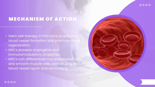 Stem Cell Therapy's Role in Managing Peripheral Artery Disease | Dr ...