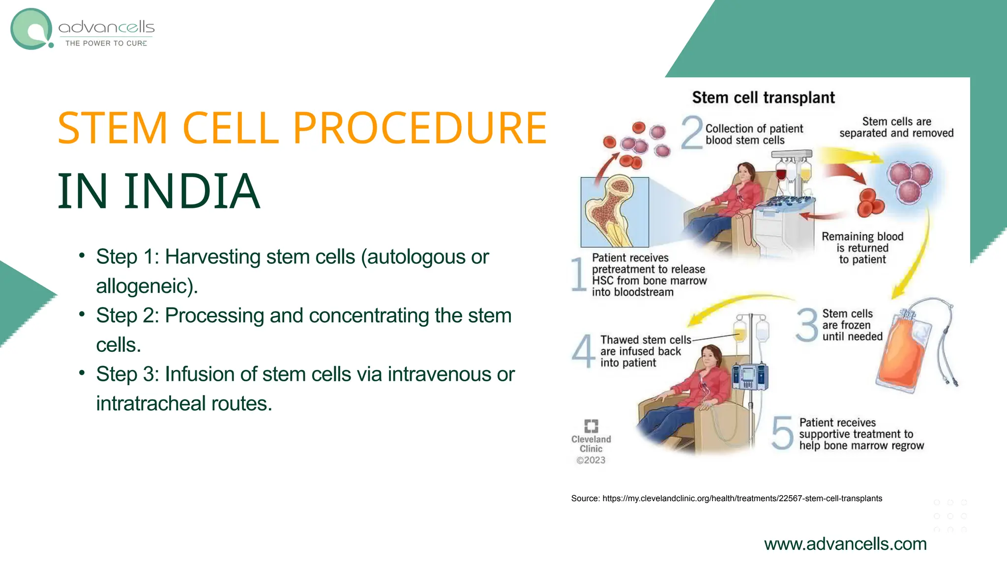 Stem Cell Treatment Options for COPD and Pulmonary Fibrosis in India | PPTX