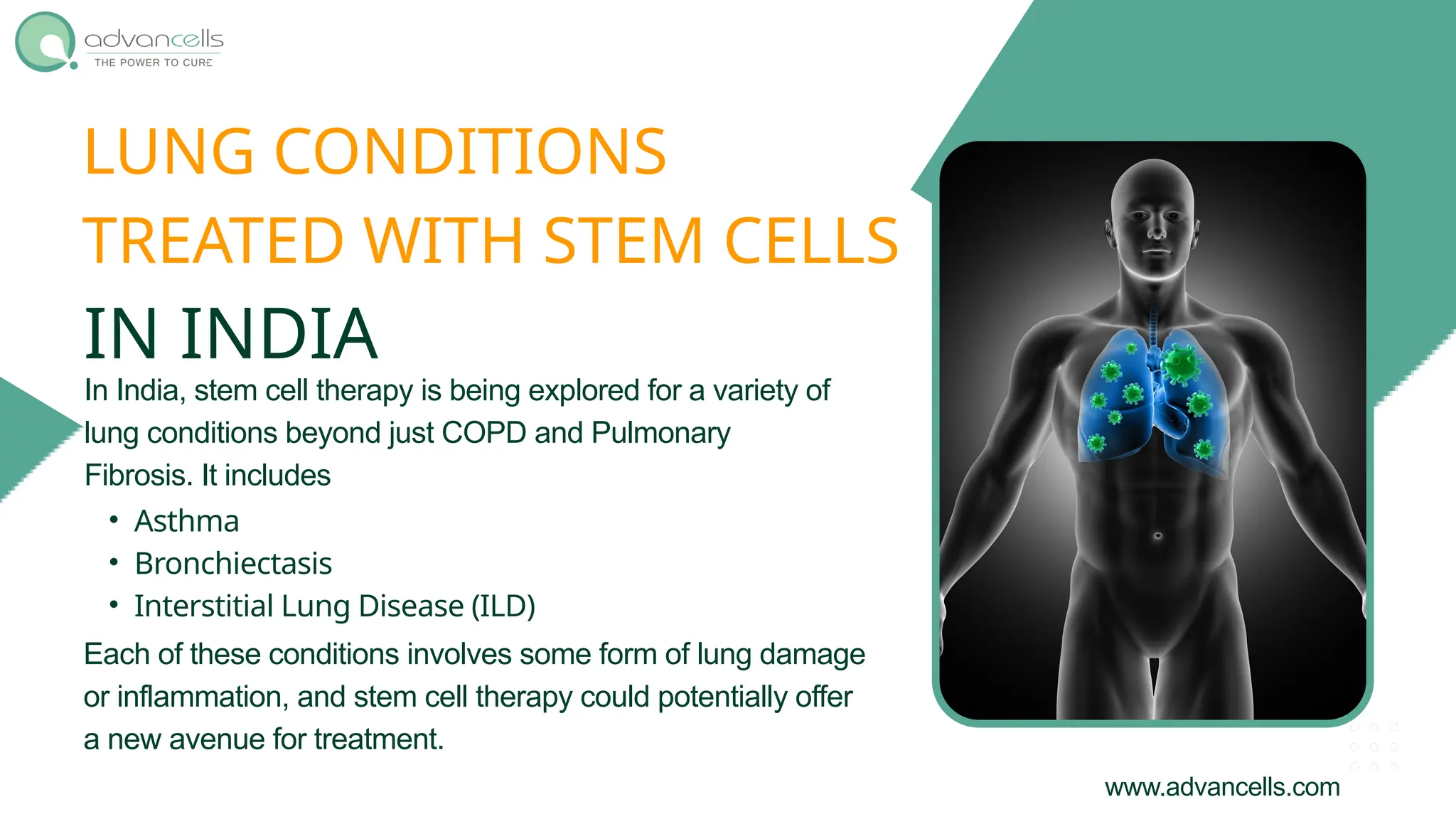 Stem Cell Treatment Options for COPD and Pulmonary Fibrosis in India | PPTX