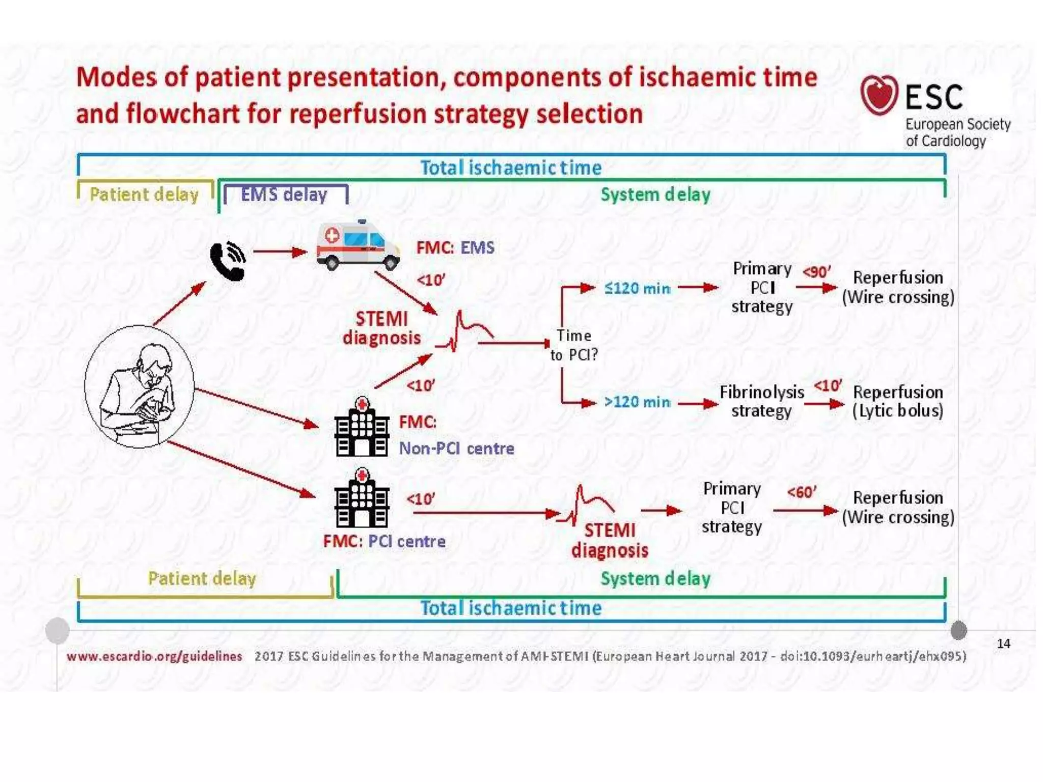 Stemi | PPT