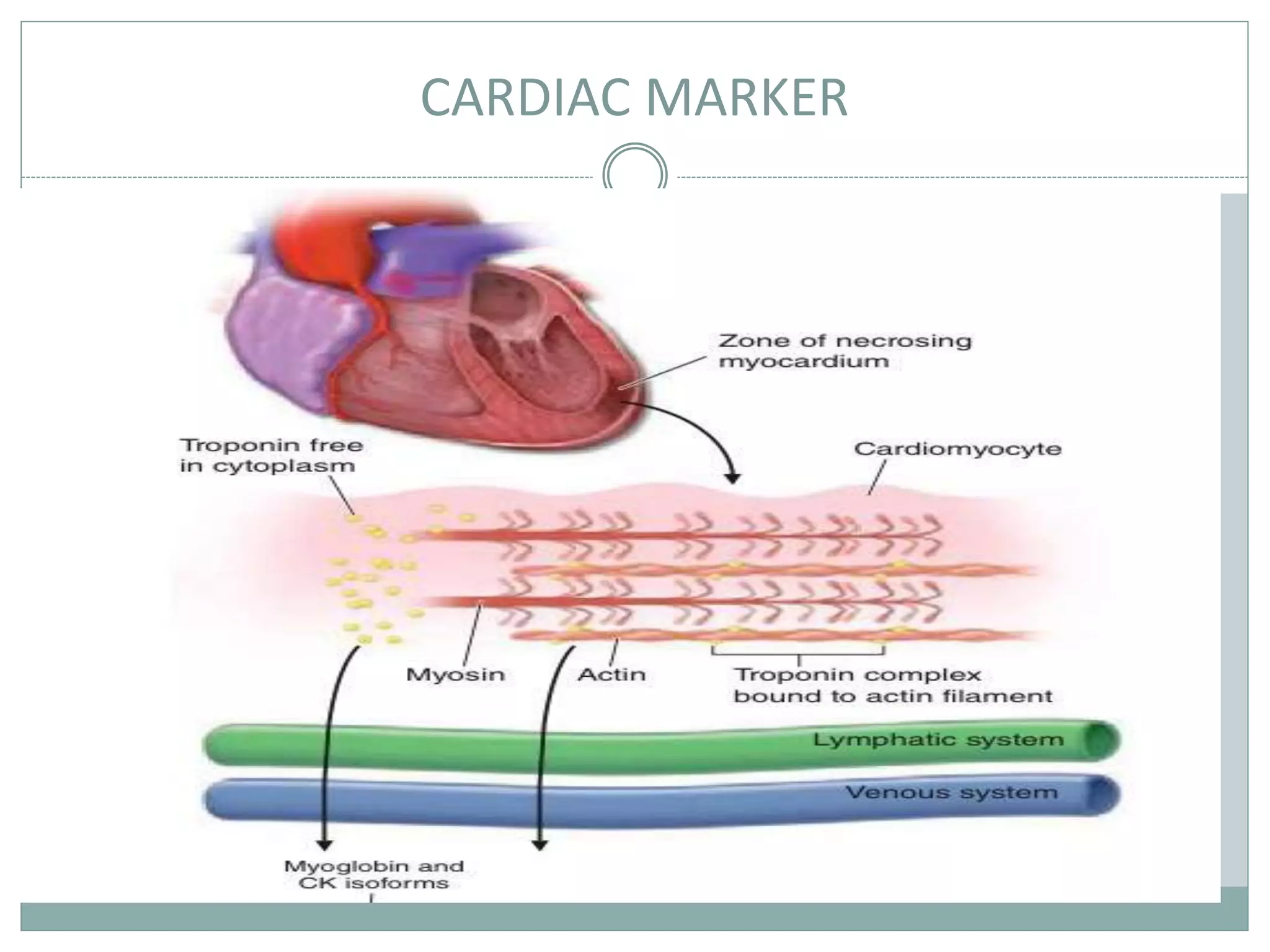 Stemi | PPTX