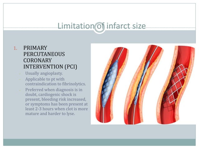 Stemi | PPTX | Heart and Cardiovascular Diseases | Diseases and Conditions