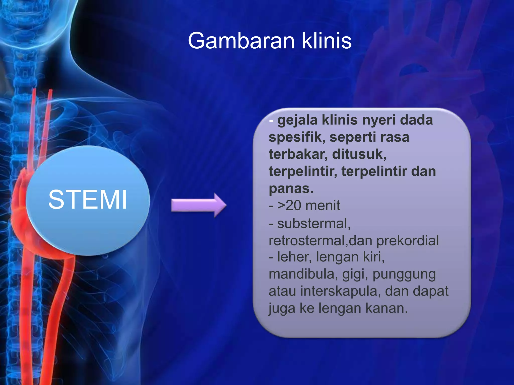 Laporan Kasus ACS STEMI | PPT