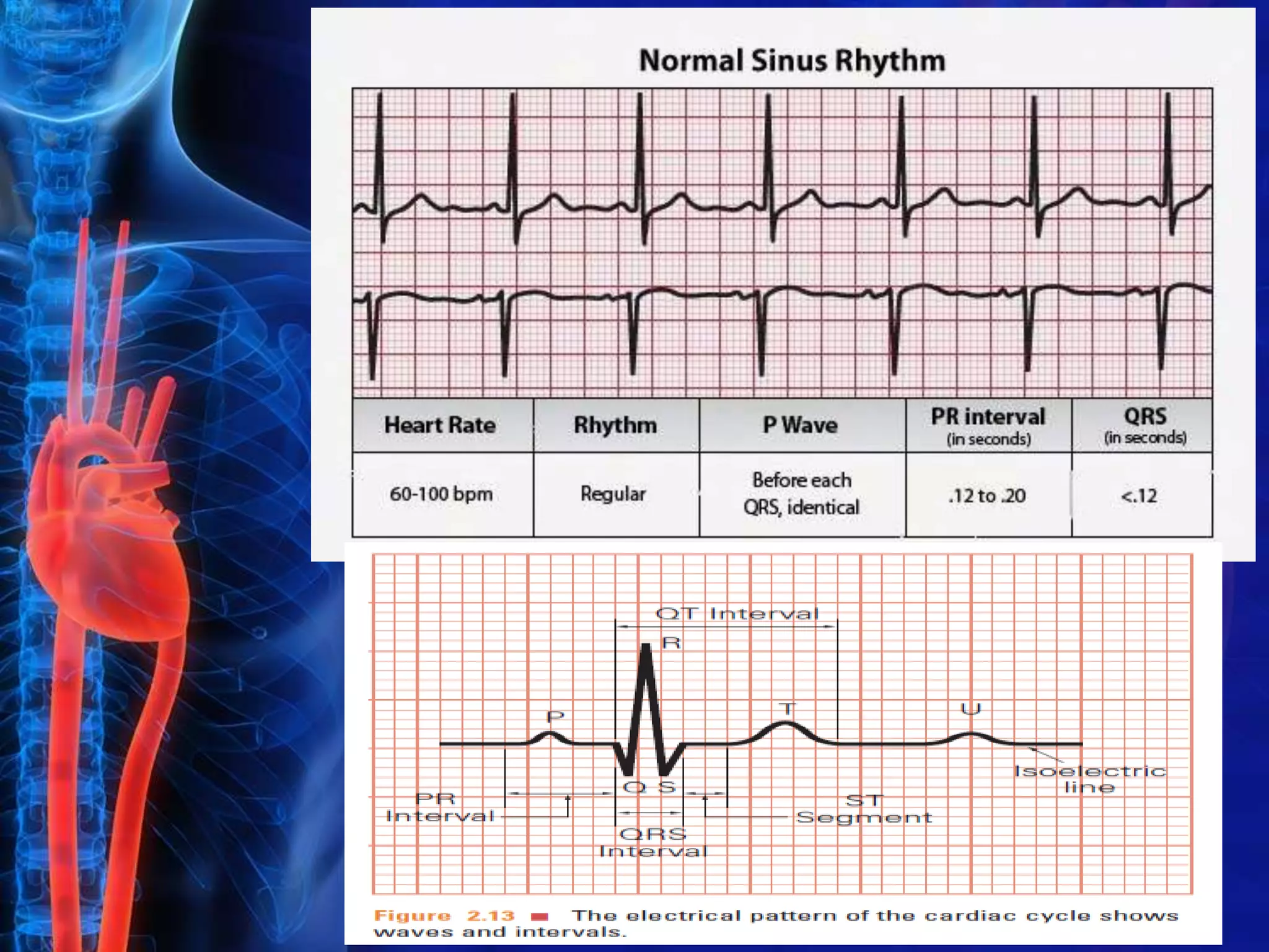 Laporan Kasus ACS STEMI | PPTX