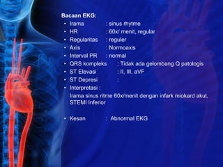 Laporan Kasus ACS STEMI | PPTX