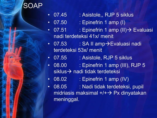 Laporan Kasus ACS STEMI | PPT