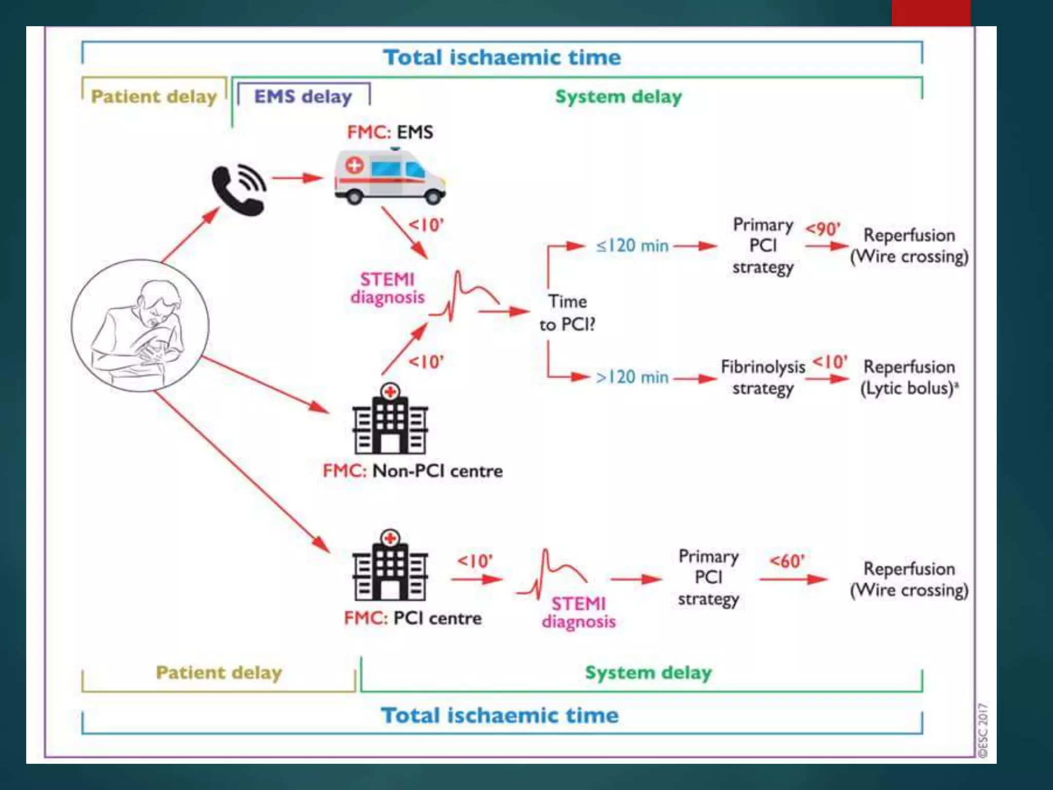 Stemi by dr.mehelina | PPTX