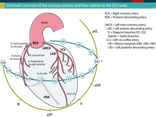 Stemi by dr.mehelina | PPT