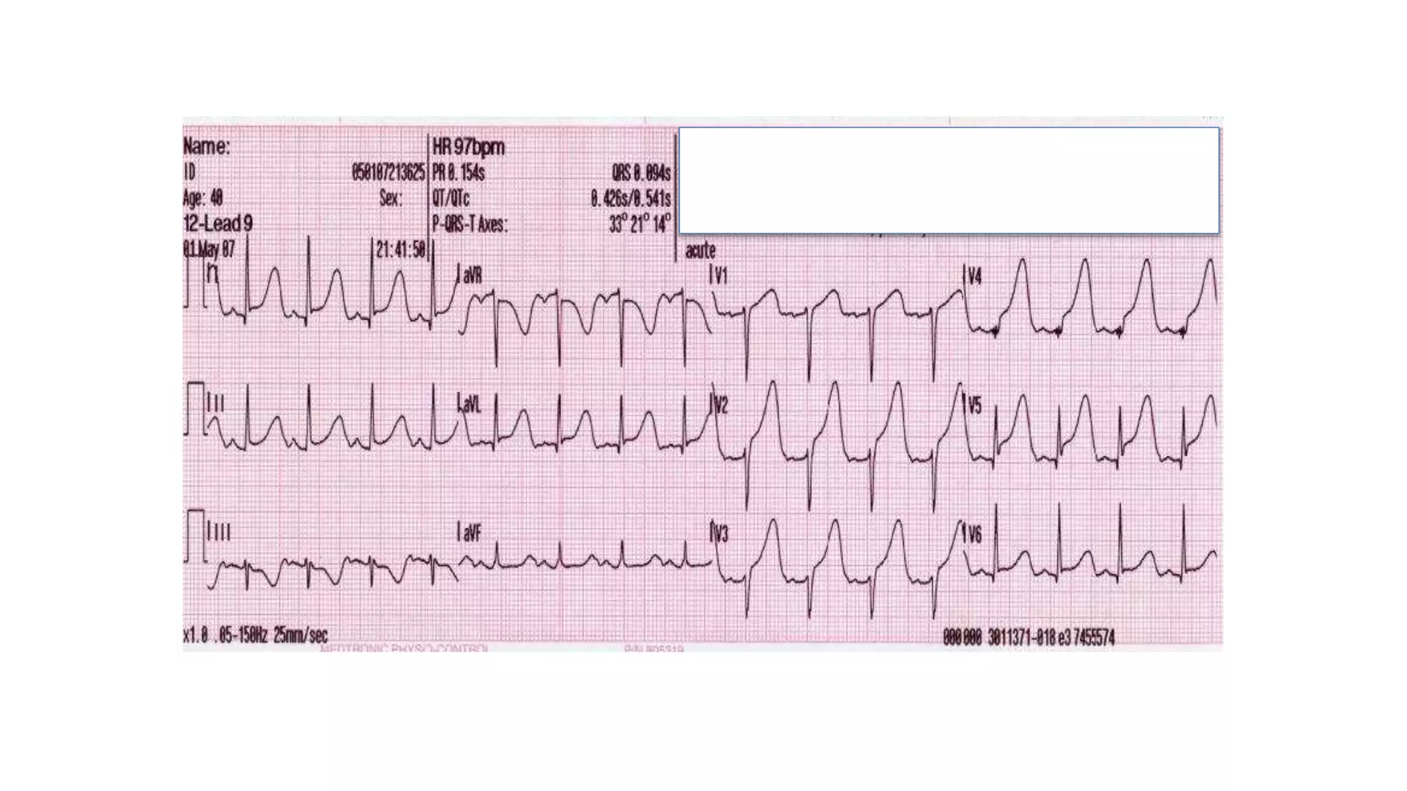 STEMI case scanarios | PPTX