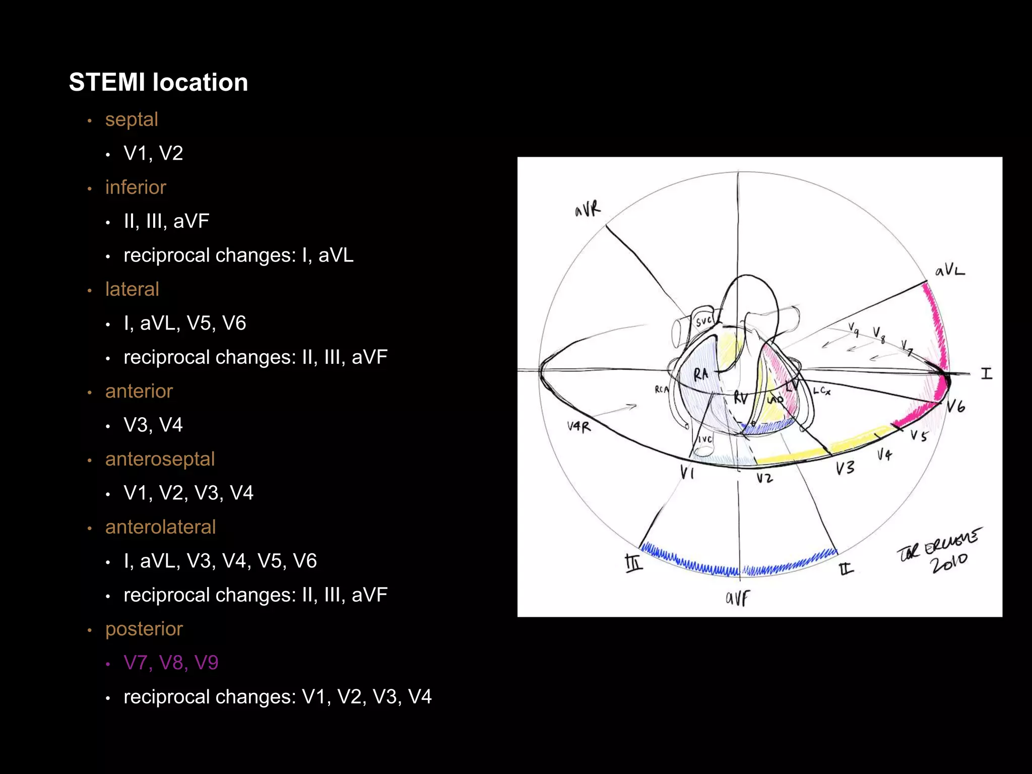 Stemi criteria | PPTX