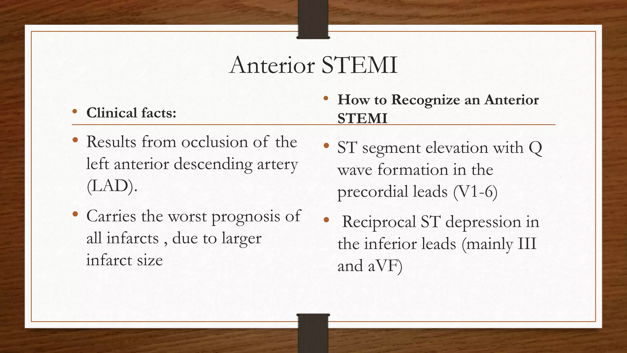 ST elevation myocardial infarction ECG signs 2 | PPTX