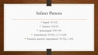 ST elevation myocardial infarction ECG signs 2 | PPT