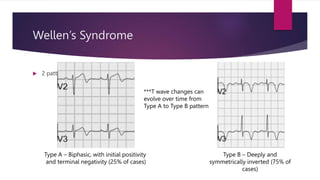 STEMI EQUIVALENT 1.pptx