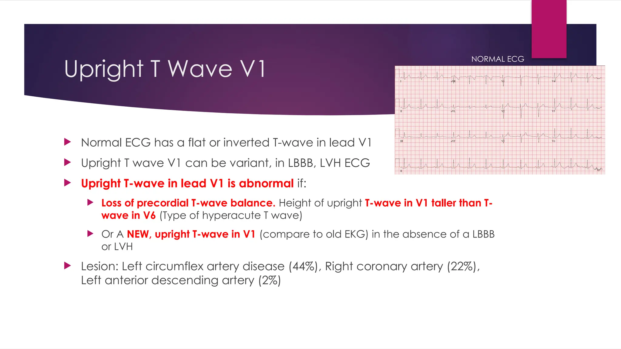stemiequivalent1 presentation new.pptx