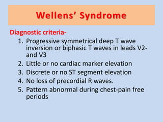 Stemi equivalents | PPT
