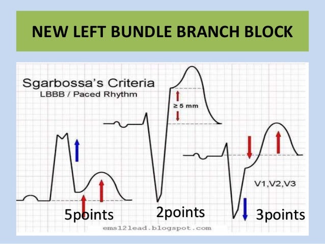 Stemi equivalents