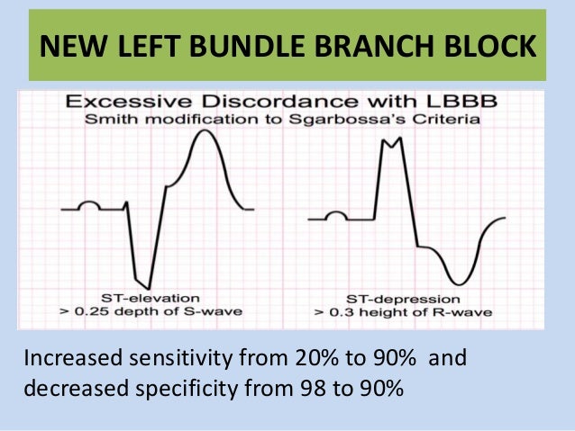 Stemi equivalents
