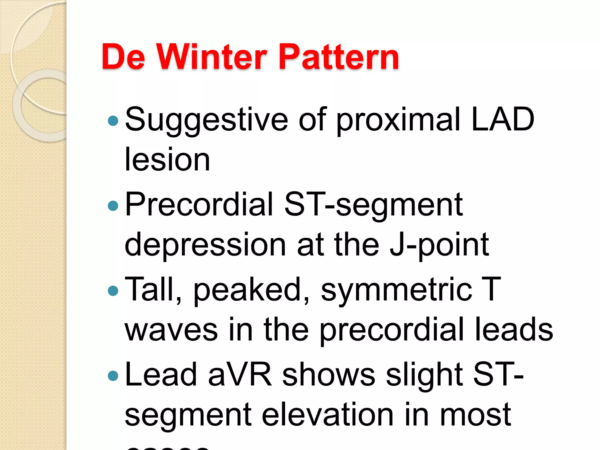 STEMI equivalents- ECG update | PPTX