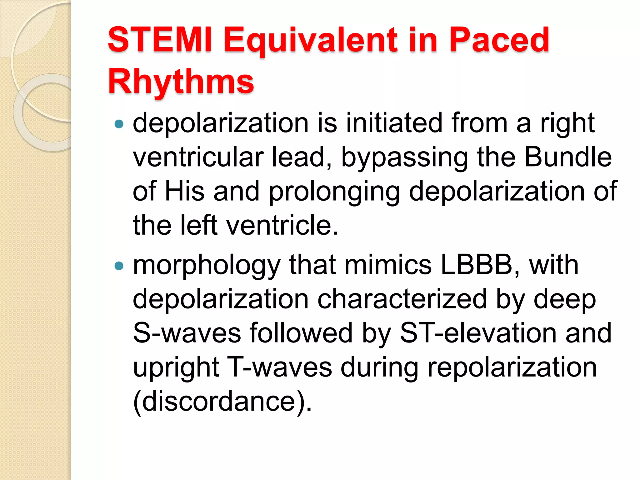 STEMI equivalents- ECG update | PPTX