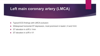 STEMI equivalents | PPTX