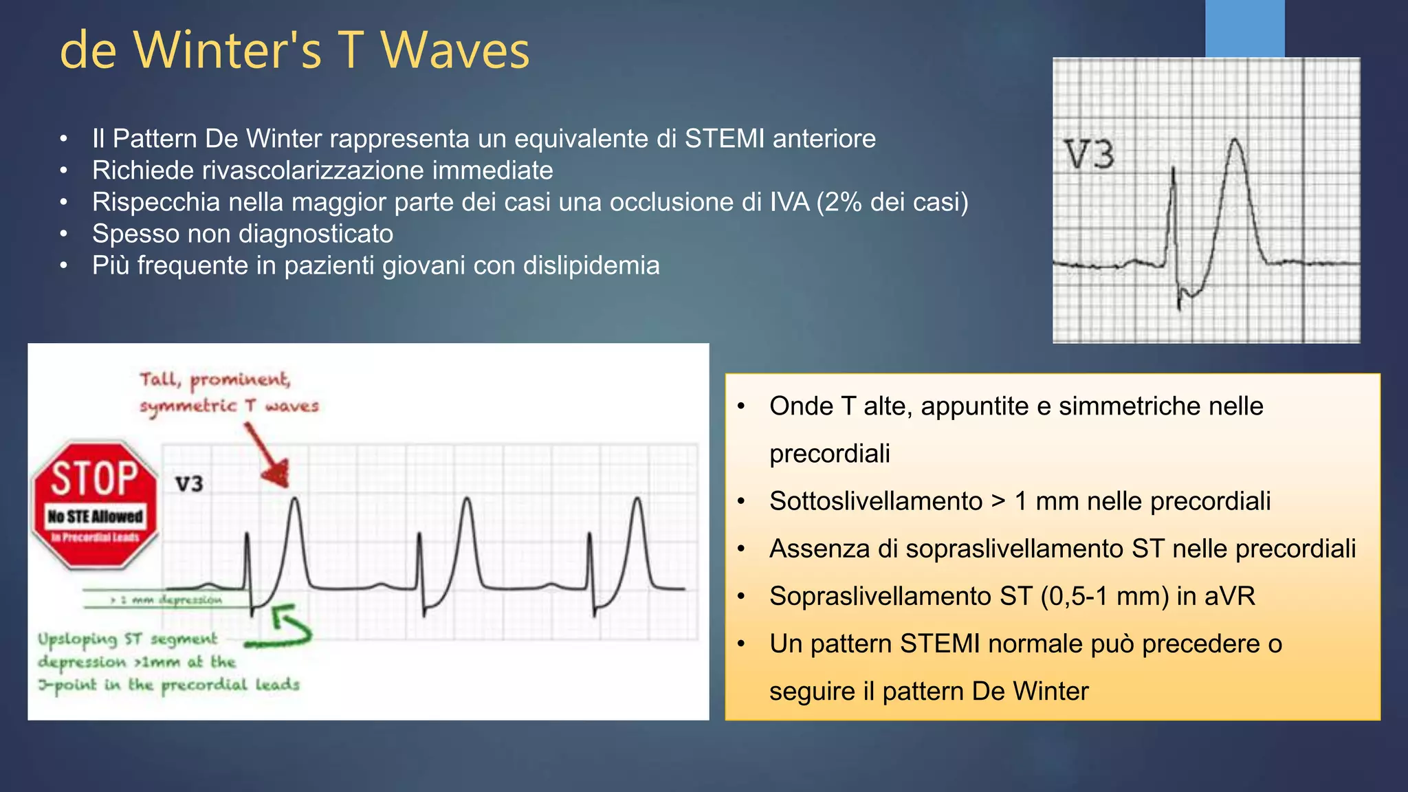 Stemi equivalents | PPTX