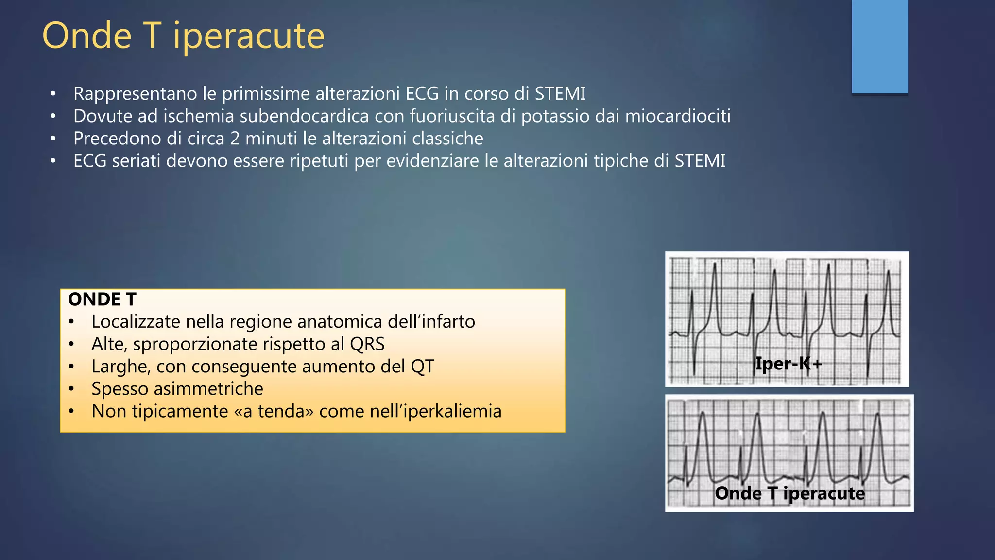 Stemi equivalents | PPTX