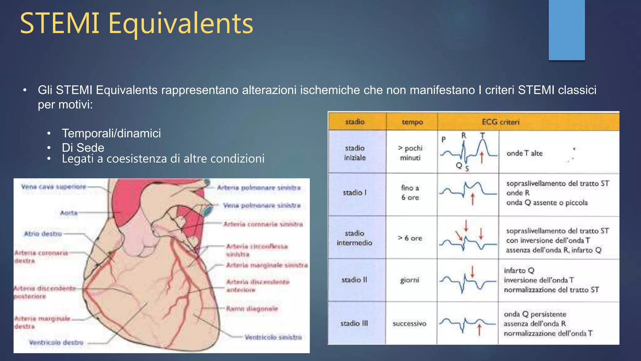 Stemi equivalents | PPTX