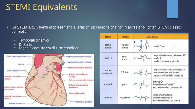 Stemi equivalents